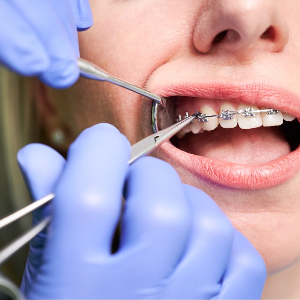 Sharpening - SA Grinding Services